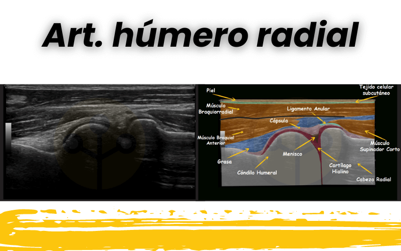 Anatomía y ecografía codo | Tempo Formación